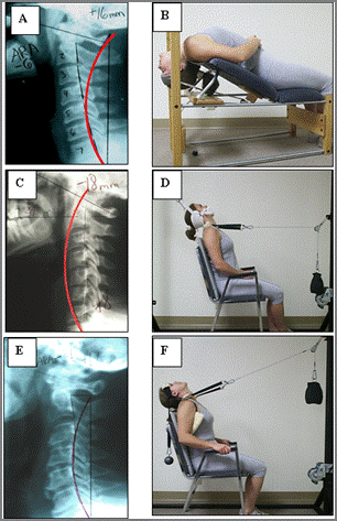 American Journal of Clinical Chiropractic - Chiropractic BioPhysics ...